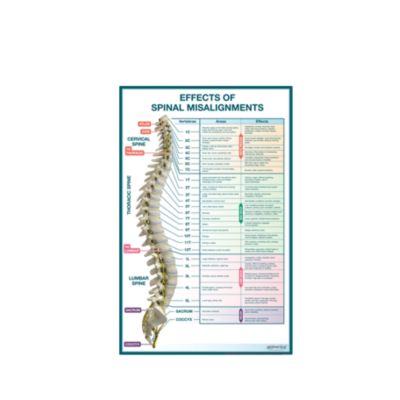 Effects of Spinal Misalignments Decal | Shop Fathead Anatomical Images ...