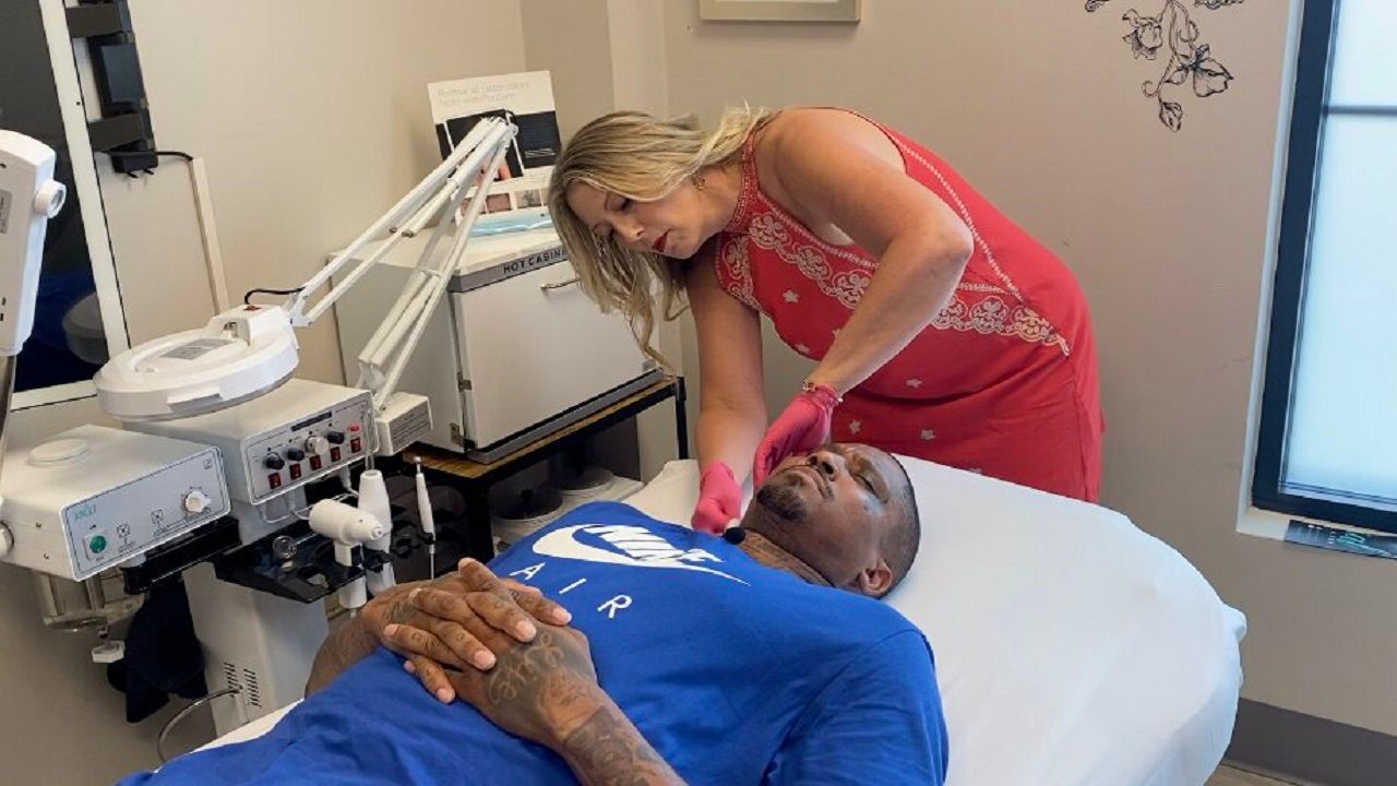 Tattoo removal program