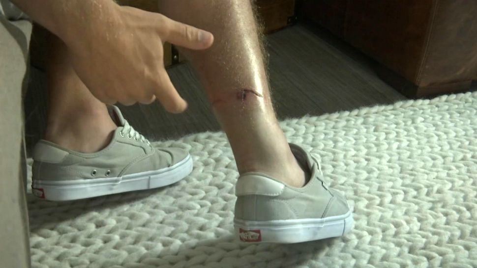 New Smyrna Beach man survives grizzly bear attack