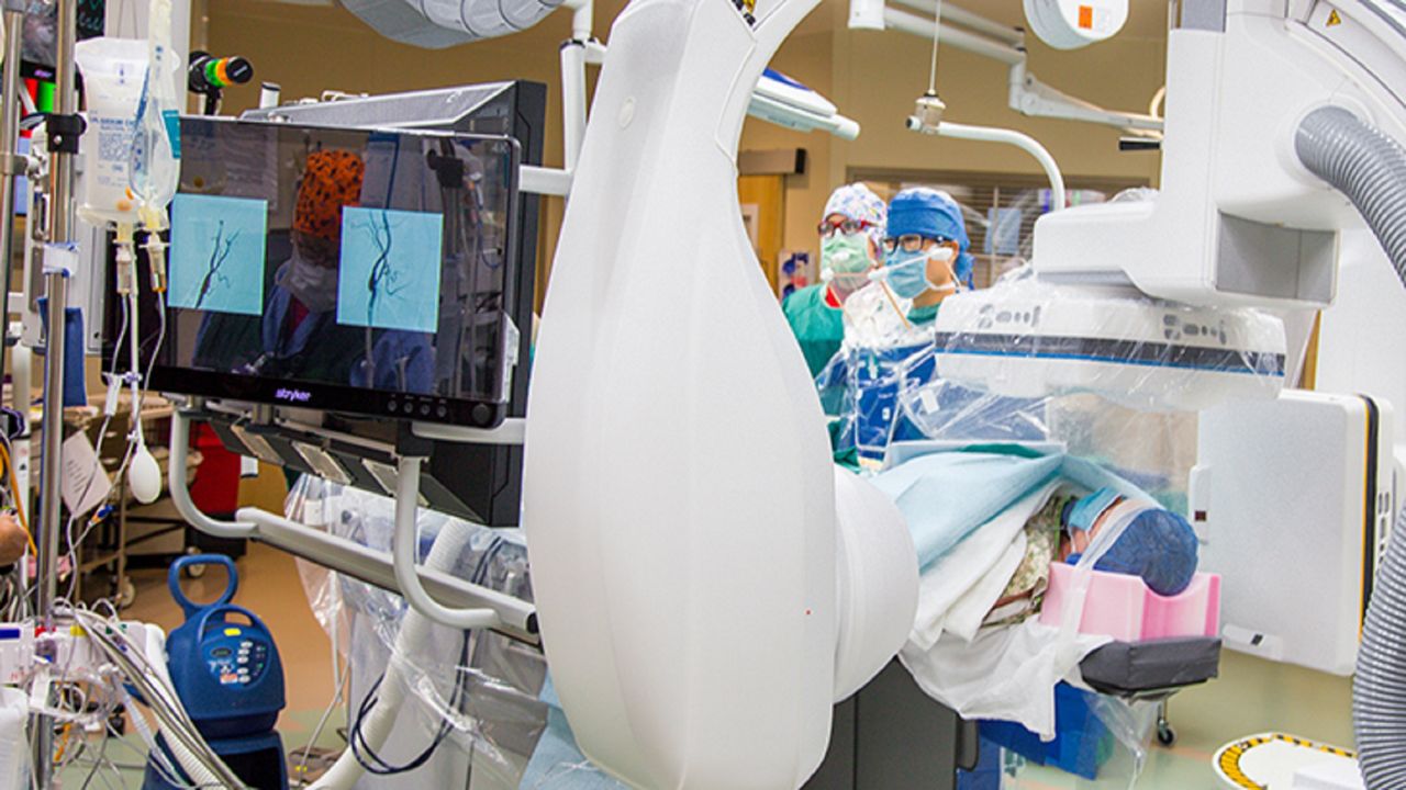 Biplane X-Ray Technology Helps Enhance Stroke Treatments