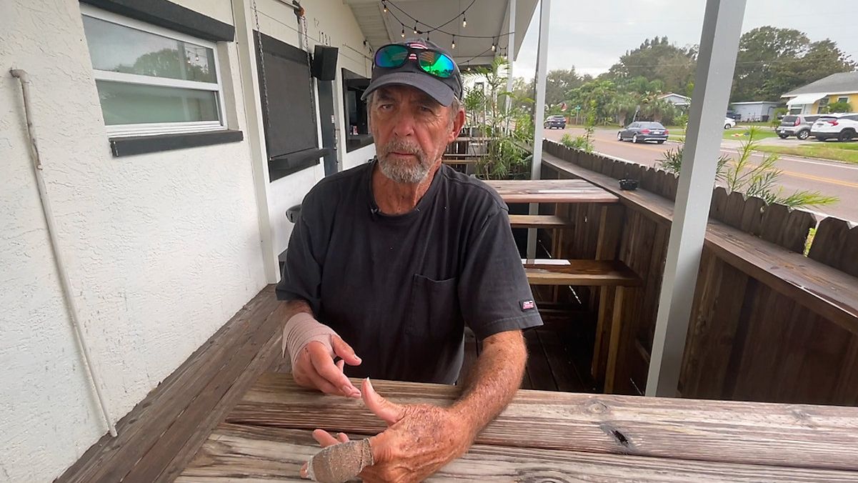 Man speaks out after being beaten by strangers in St. Pete - Best of ... Man speaks out after being beaten by strangers in St. Pete - Best of ...