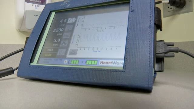 A Growing Number of Americans Under 40 are Dealing with Heart Failure ...