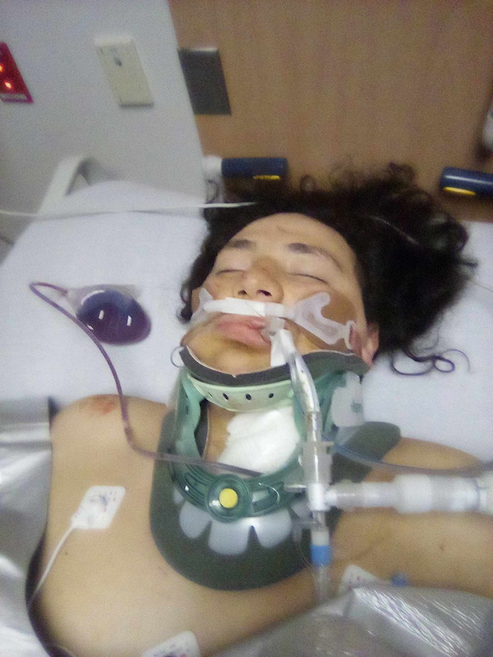 Teenage Worcester shooting victim in the ICU