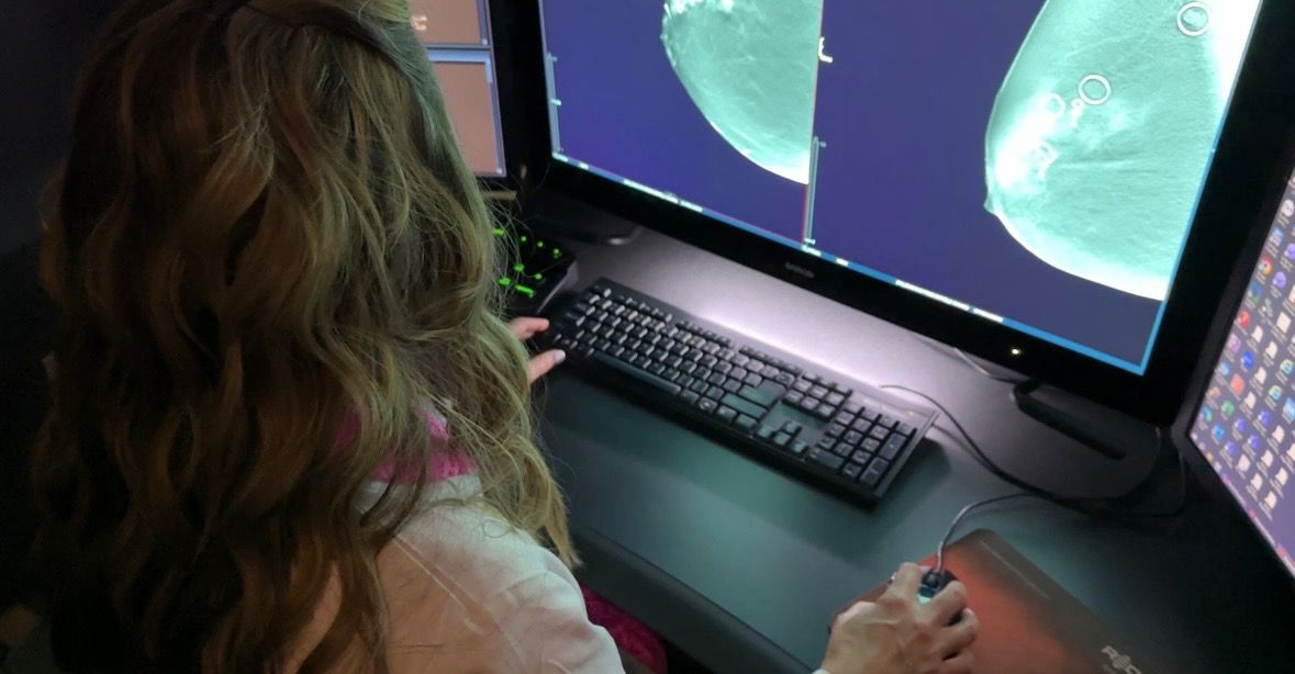 Artificial intelligence can help detect breast cancer