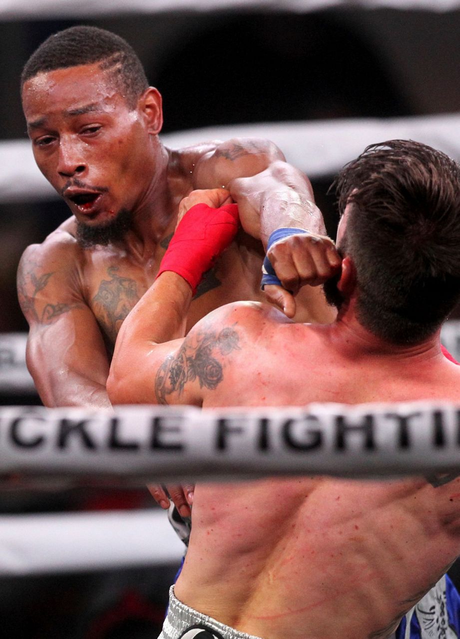 Legal bare-knuckle fighting makes bloody debut in Wyoming Legal bare-knuckle fighting makes bloody debut in Wyoming