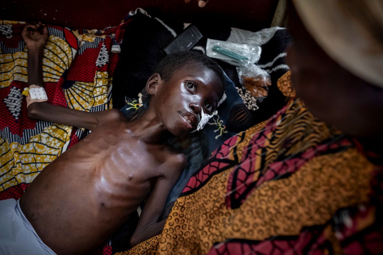 Children suffering in Central African Republic 5 years on