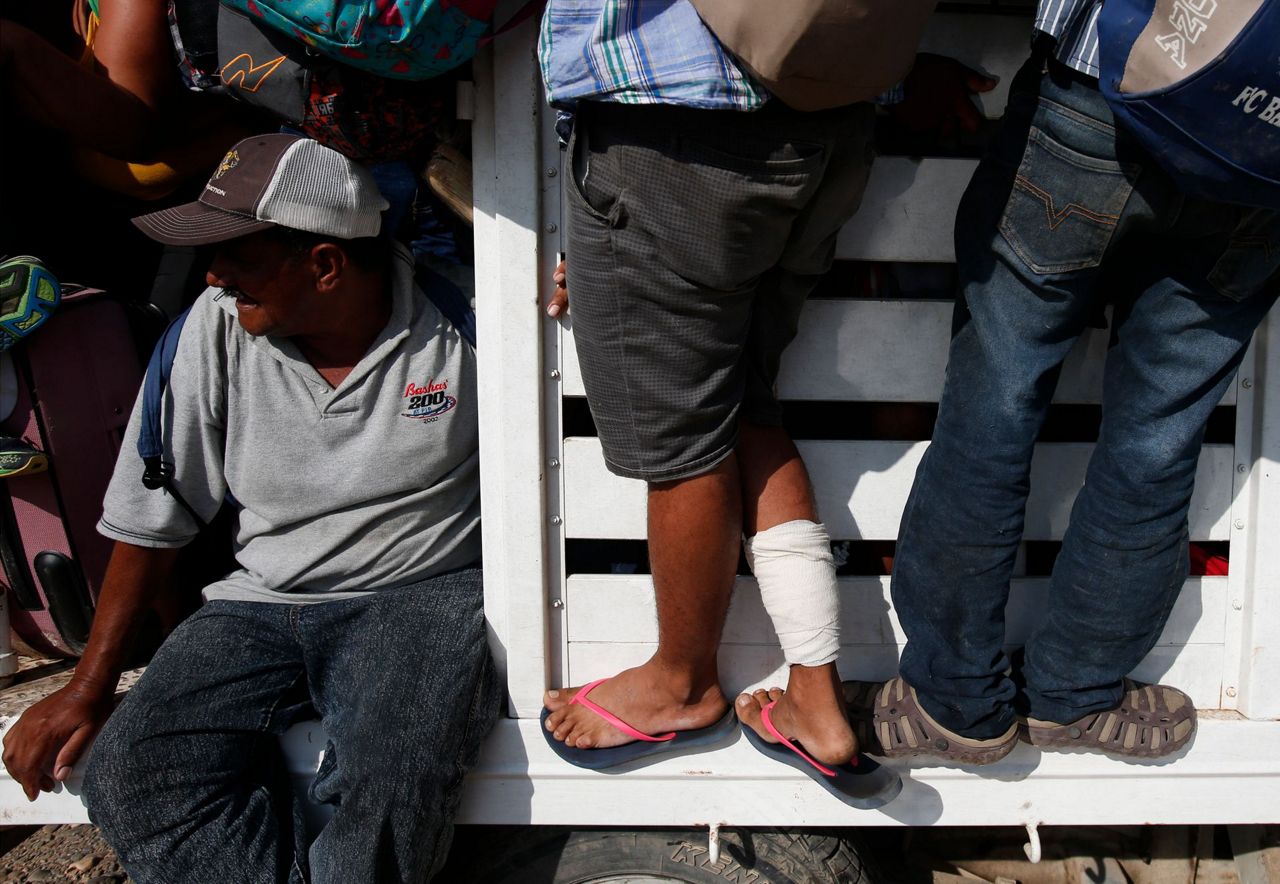 Swollen and blistered feet are big challenge for migrants