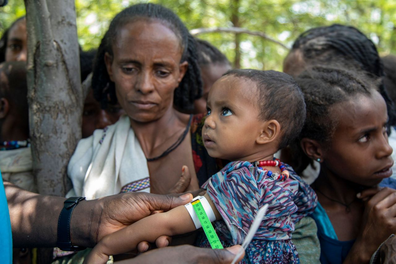UN: 100,000 children in Ethiopia's Tigray face deadly hunger