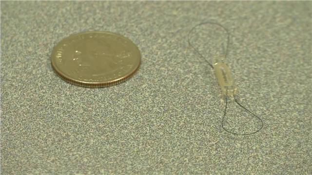 Quarter-Sized Device Helps Doctors Monitor Heart Patients