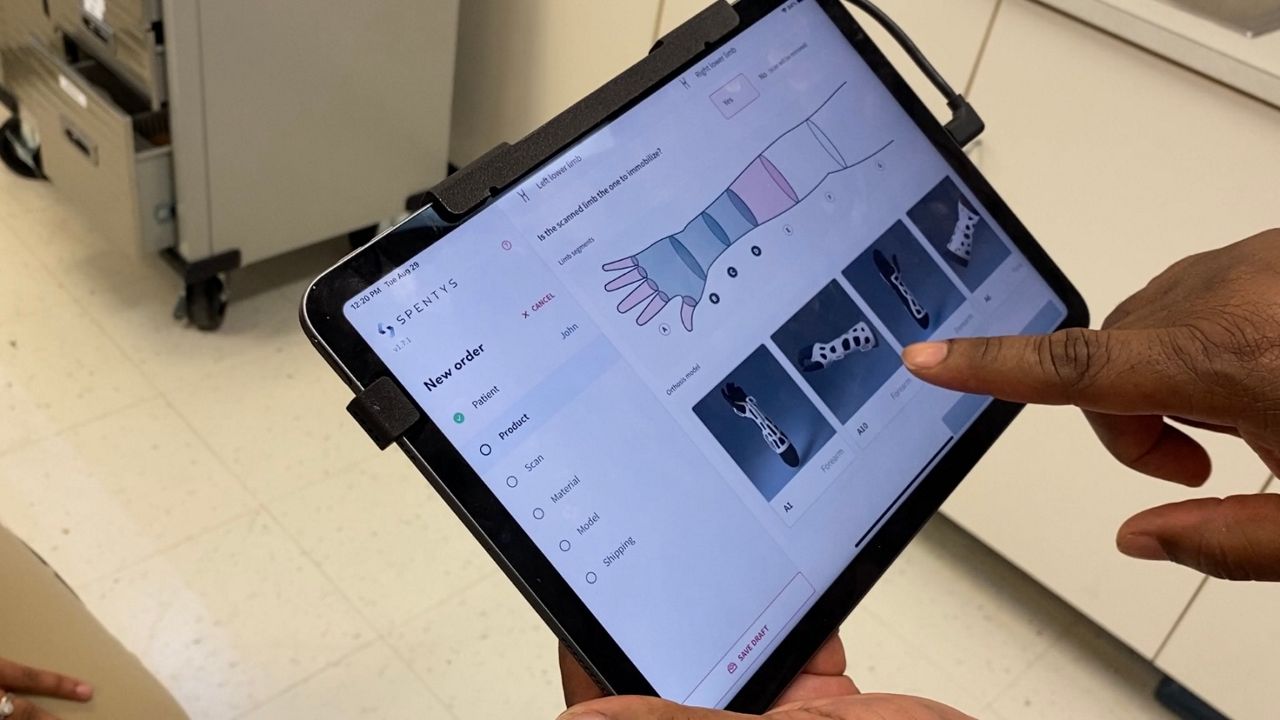 3D printing splints at WSSU