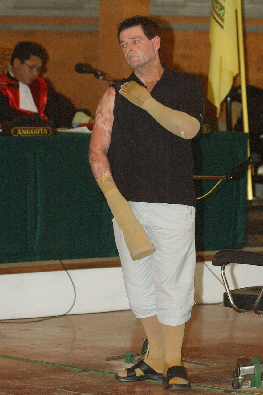 20 years later, Bali bombing survivors still battling trauma