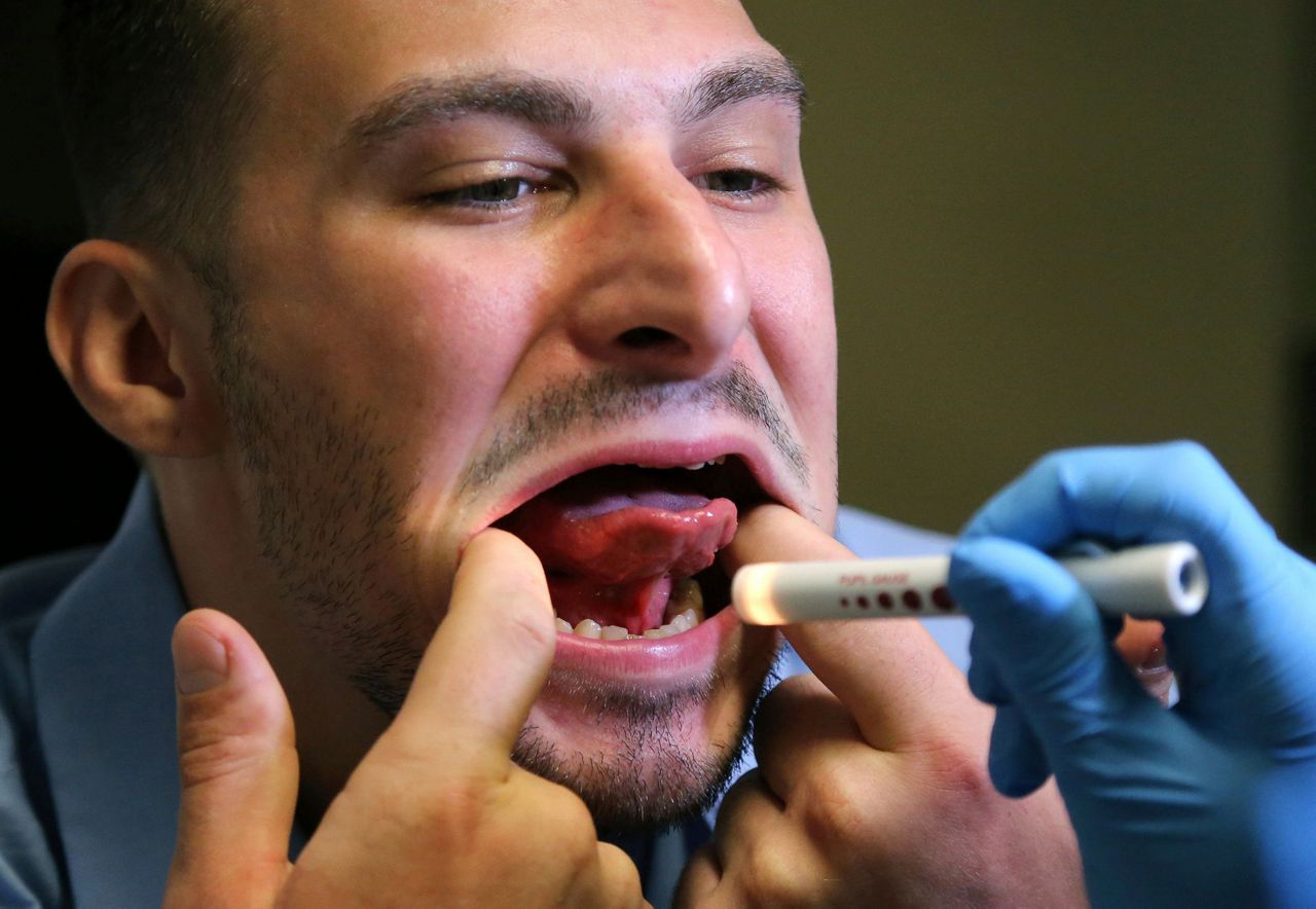 Jails, prisons slowly loosen resistance to addiction meds