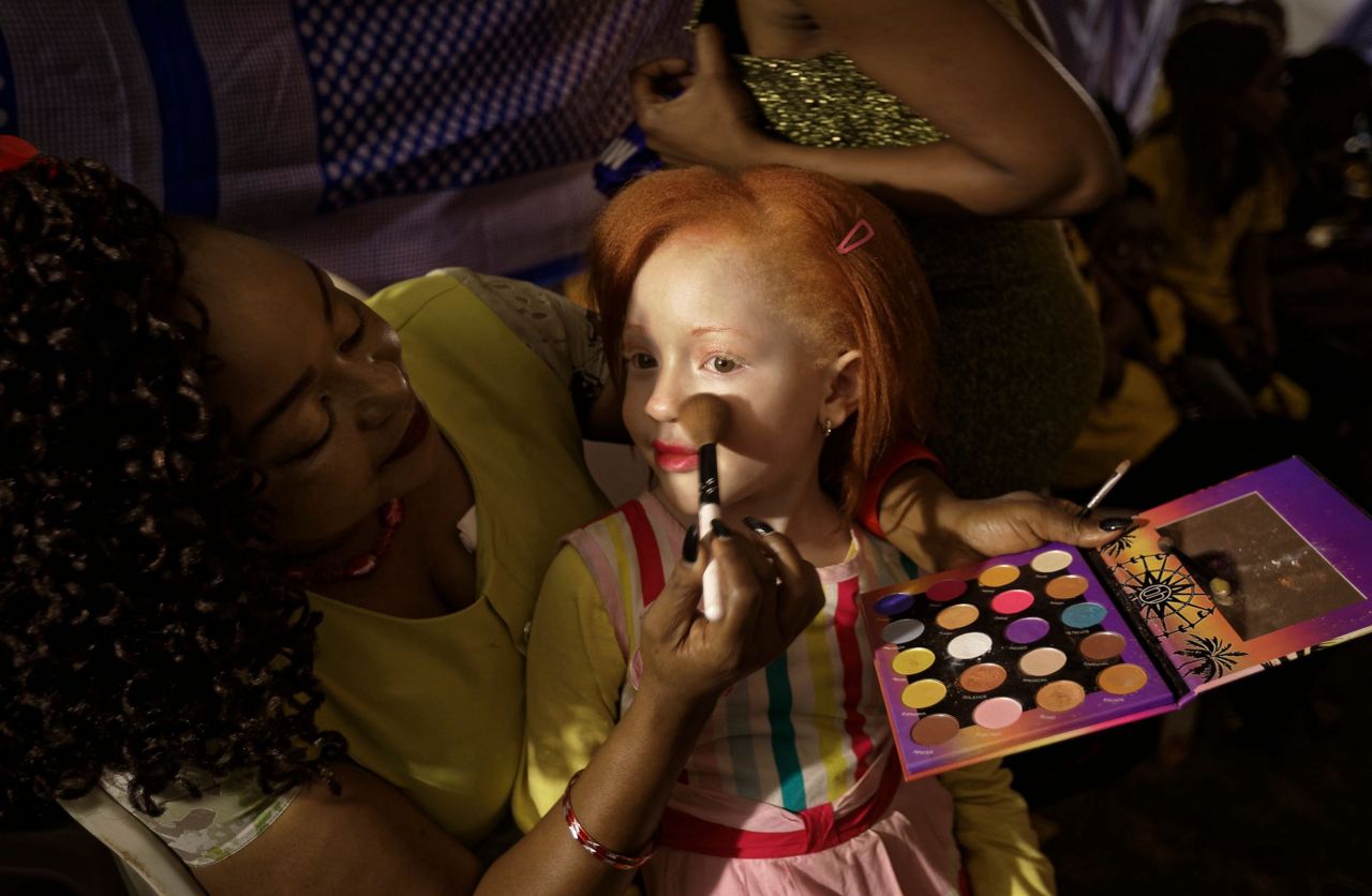 A groundbreaking beauty pageant for those with albinism