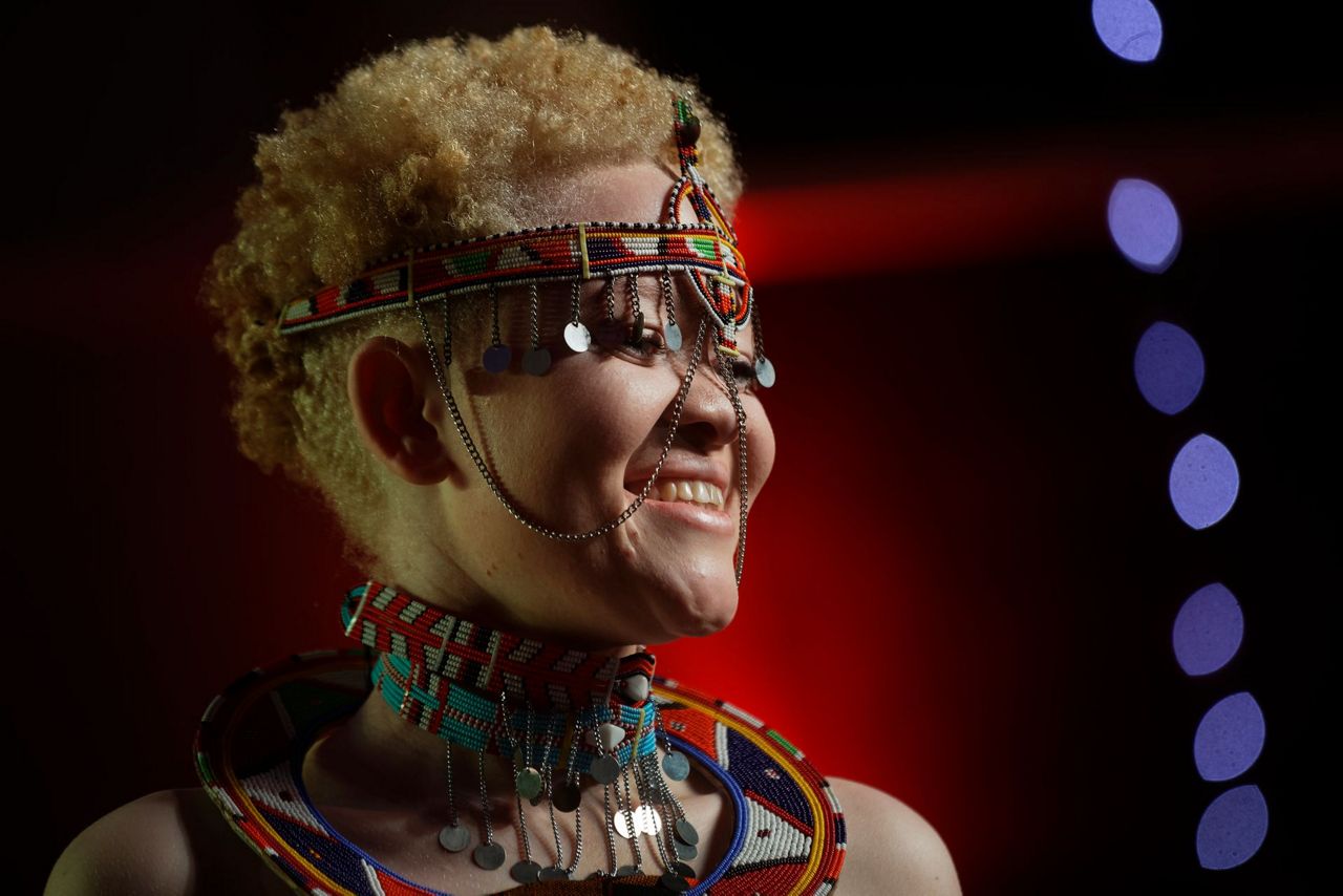 A groundbreaking beauty pageant for those with albinism