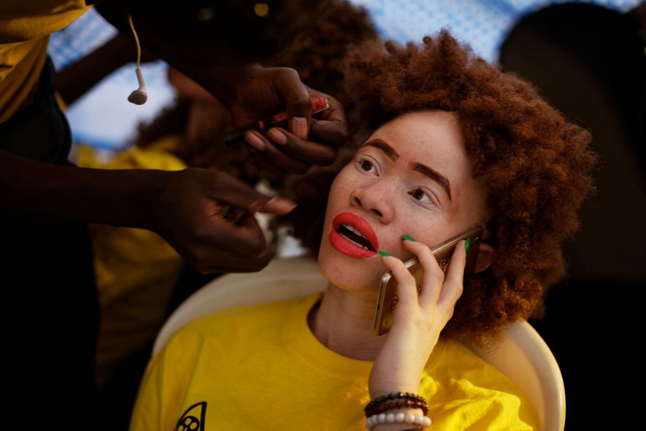 A groundbreaking beauty pageant for those with albinism