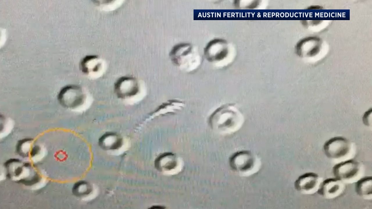 Central Texans share personal male infertility journeys