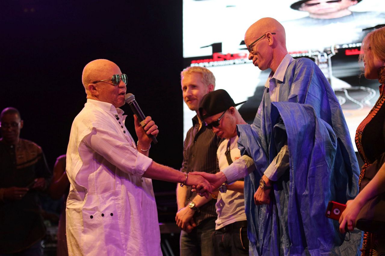 Mali singer, albino activist raises awareness of violence