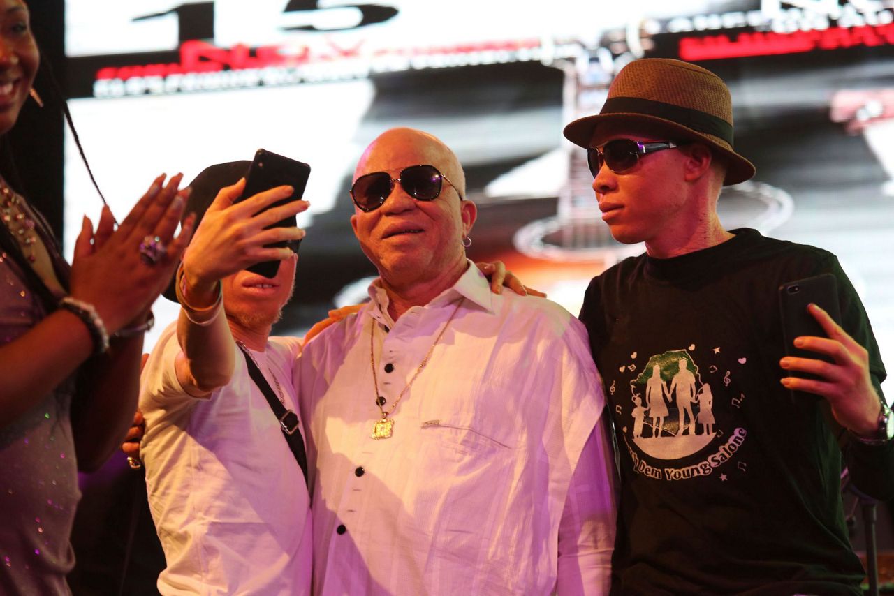 Mali singer, albino activist raises awareness of violence