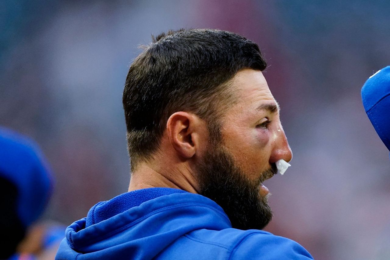 Mets' Pillar has multiple nasal fractures after hit by pitch