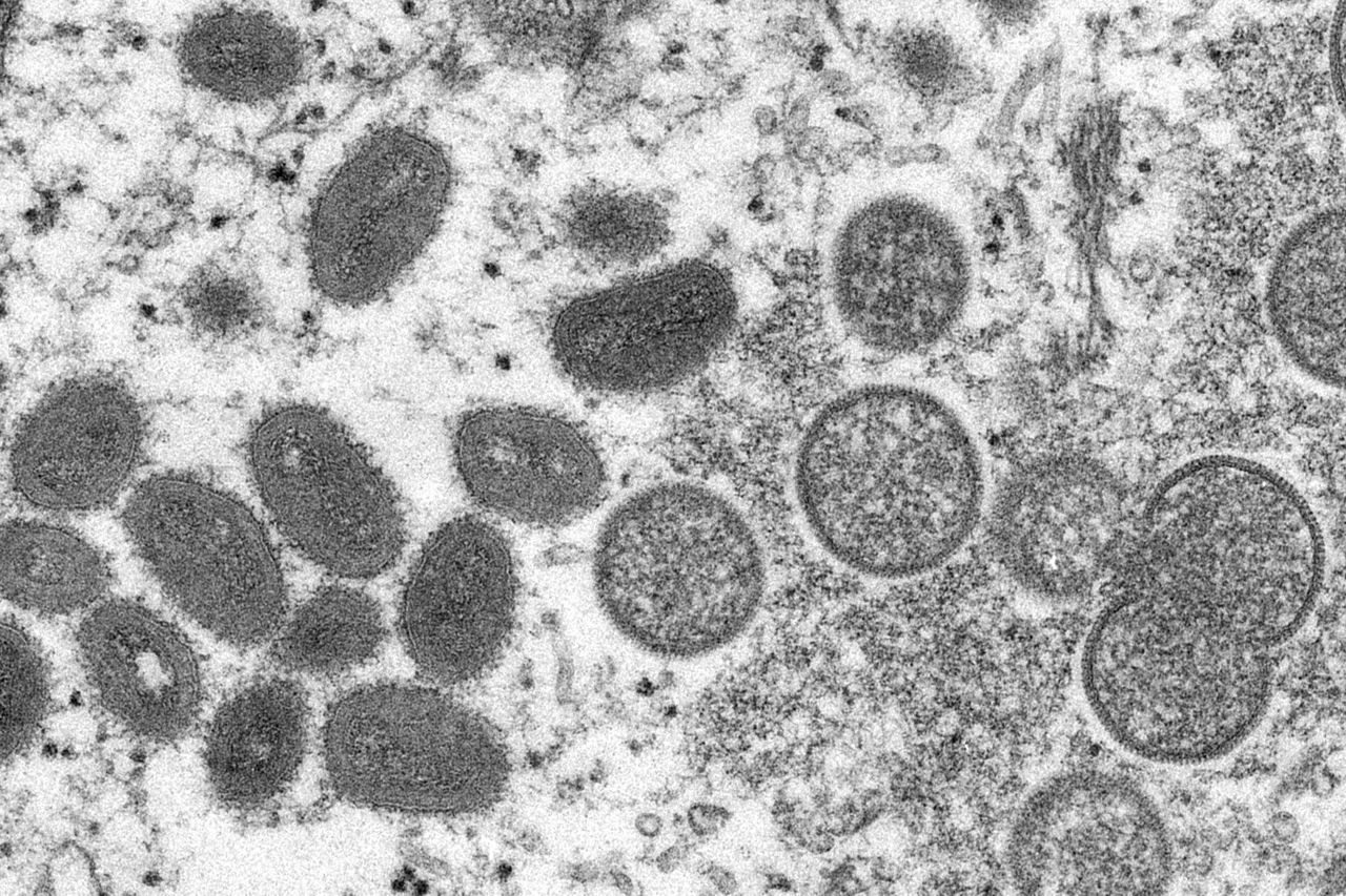 Africa CDC in 'advanced' talks to obtain monkeypox vaccines