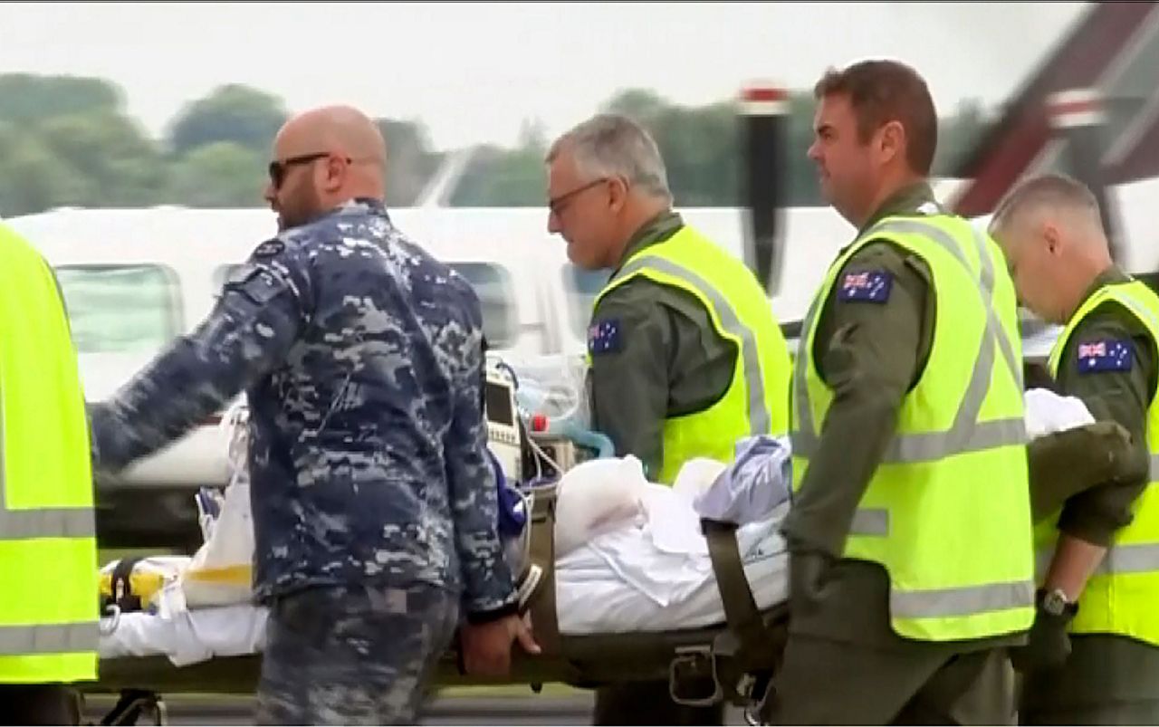 New Zealand hospitals order skin to treat volcano survivors