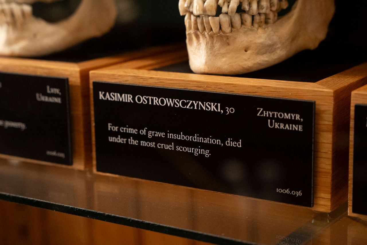 Medical museum in Philadelphia overhauls policies on human remains to ...