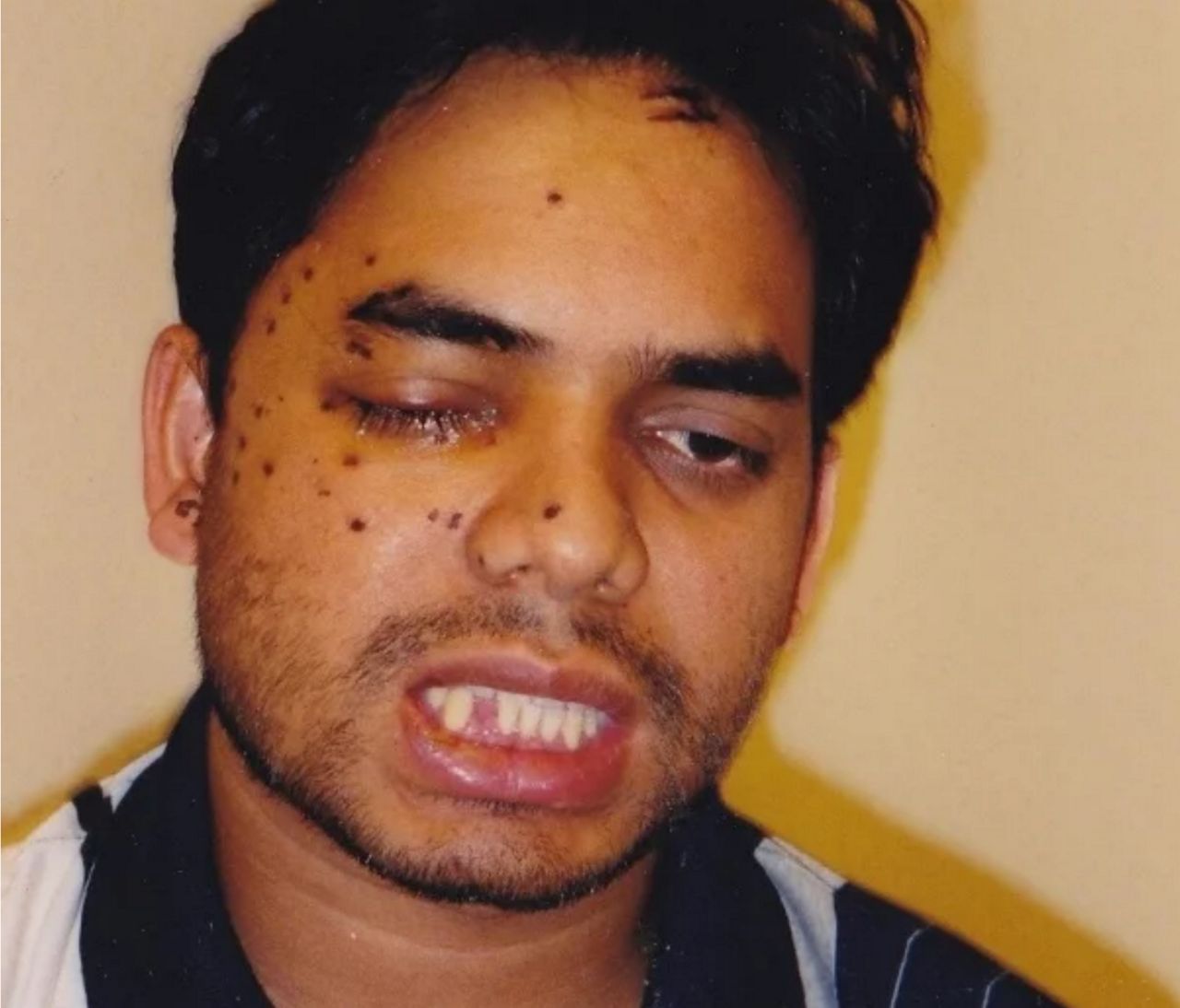 Man shot after 9/11 shares story of forgiveness