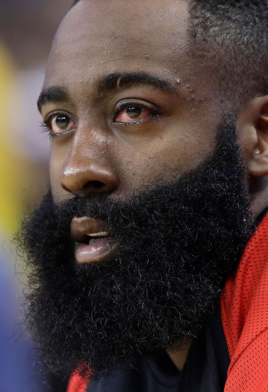 James Harden played with blurred vision and stinging eyes