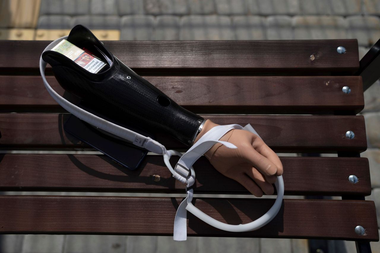 Upward of 20,000 Ukrainian amputees face trauma on a scale unseen since WWI