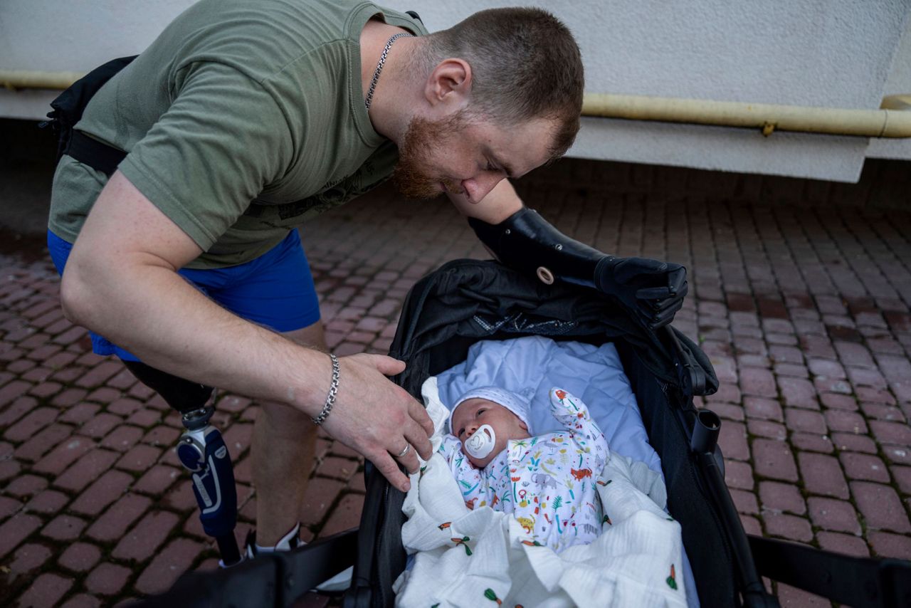 Upward of 20,000 Ukrainian amputees face trauma on a scale unseen since WWI