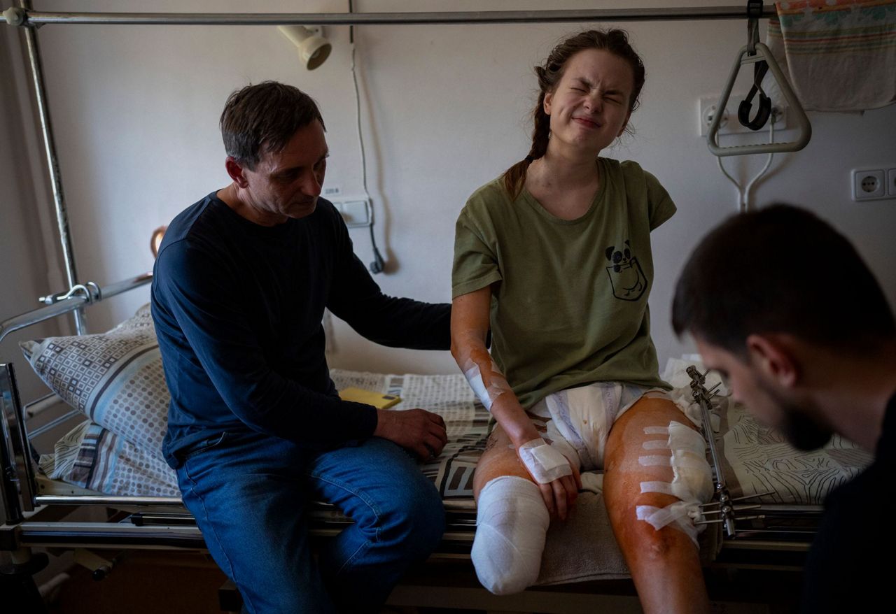 In Ukraine, limbs lost and lives devastated in an instant