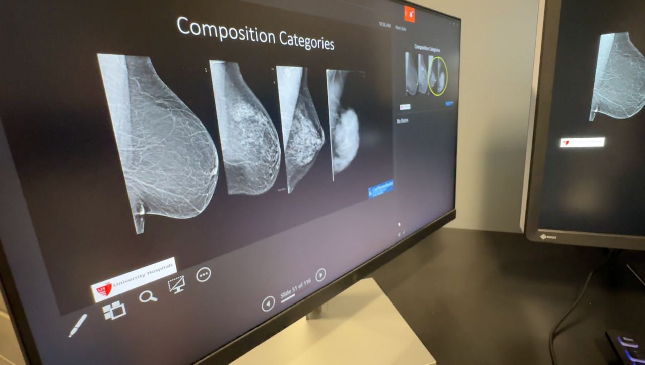 New FDA guidelines for mammograms keep patients informed