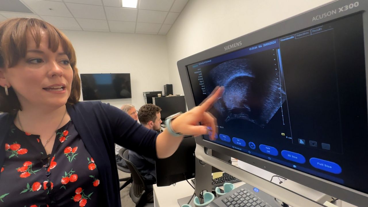 University of Cincinnati creates speech therapy video game