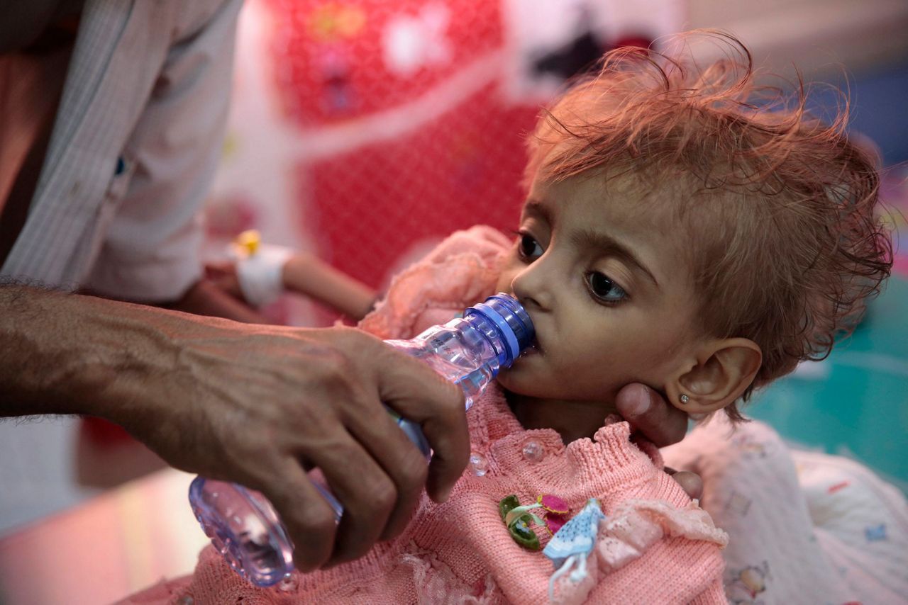 Aid group: 85,000 children may have died of hunger in Yemen