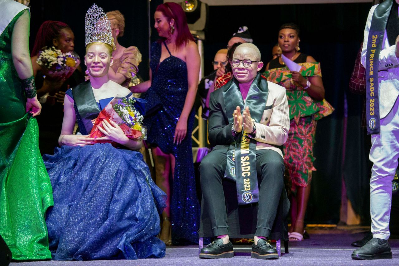 Winner of albinism pageant says Zimbabwe event made her feel beautiful ...
