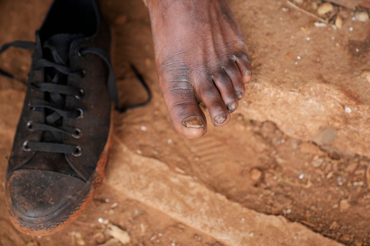 Zimbabweans count their toes as inflation soars above 130%