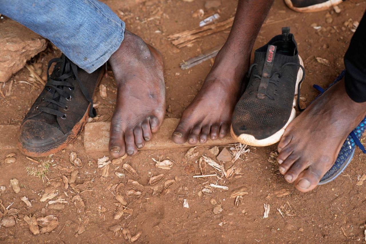 Zimbabweans count their toes as inflation soars above 130%
