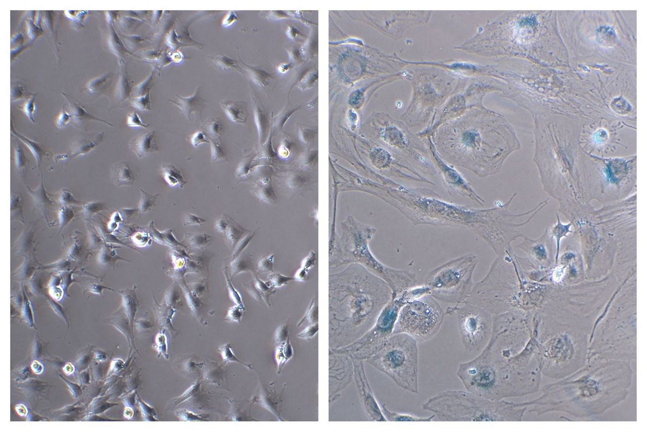 Zombie cells central to the quest for active, vital old age