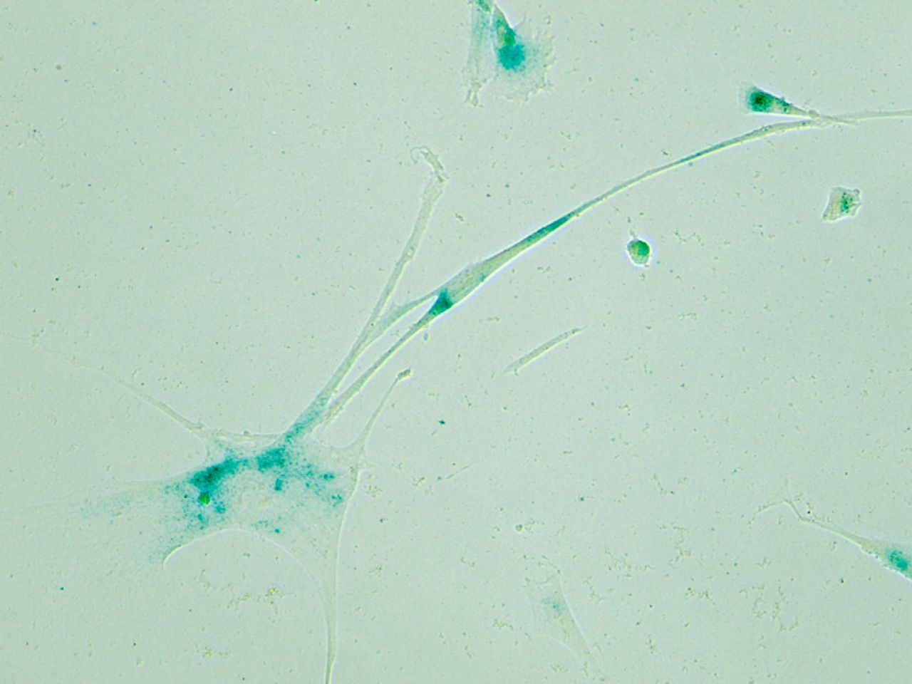 'Zombie cells' buildup in your body may play role in aging