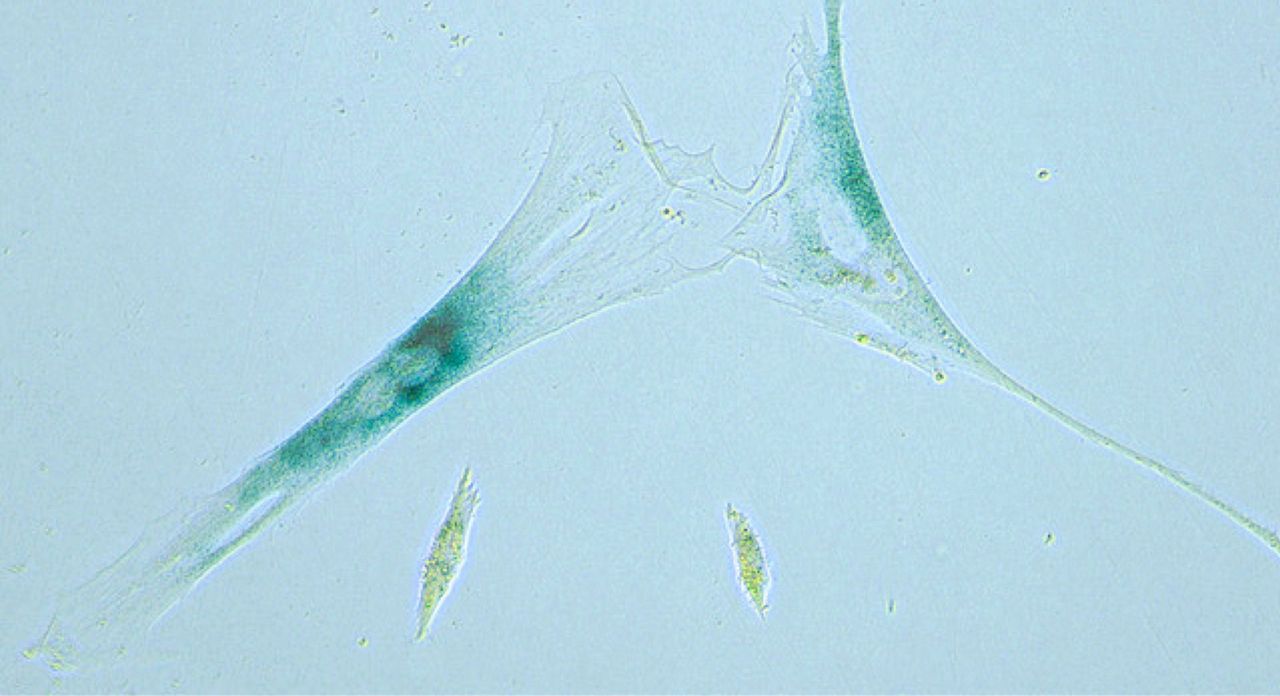 'Zombie cells' buildup in your body may play role in aging