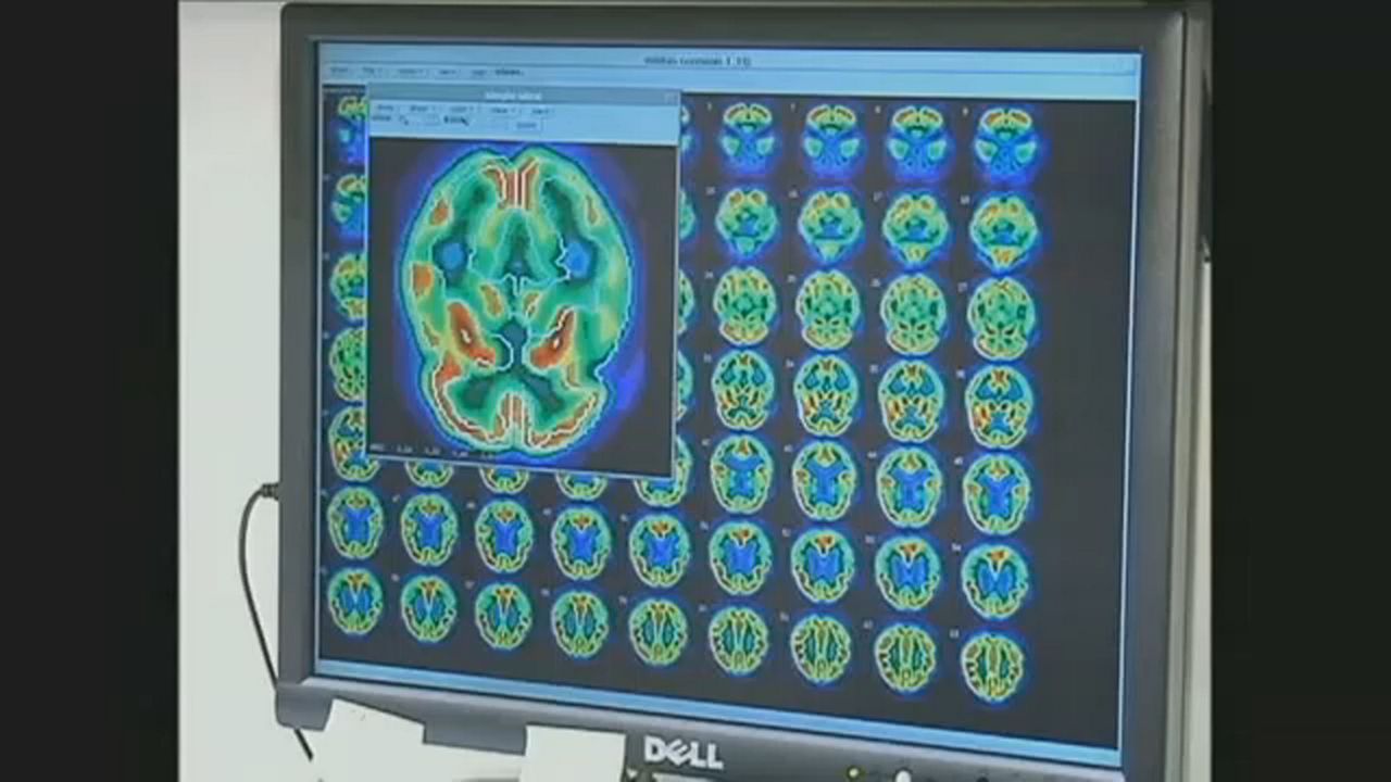 Free Alzheimer's memory screening in Chelsea