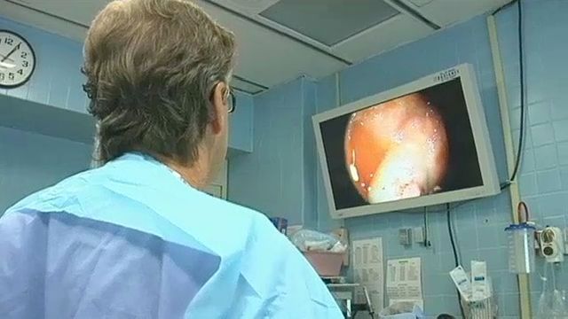 Numbers Show Early Detection is Key to Beating Colon Cancer