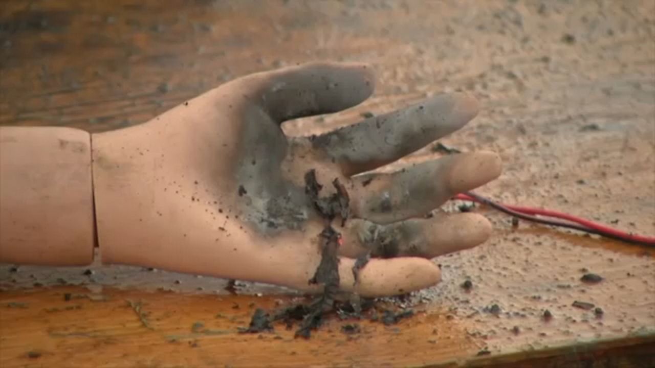 EMS Crews Prepared for Fireworks-Related Injuries