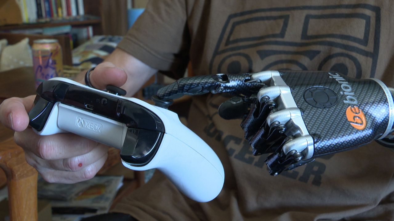 Writer With Bionic Hand Creates Video Games