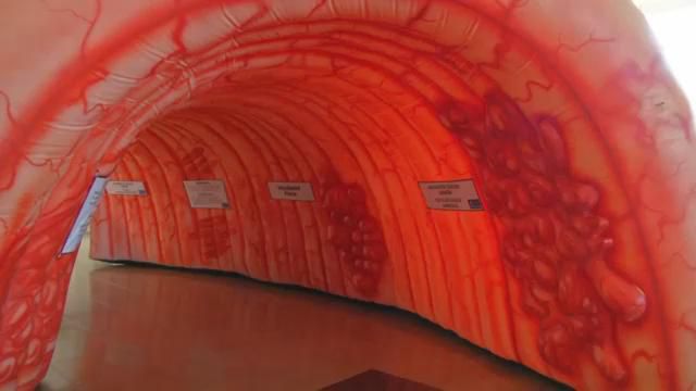 People Encouraged to Walk Through Giant Colon