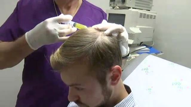 Platelet Rich Plasma Therapy Used to Improve Hair Growth