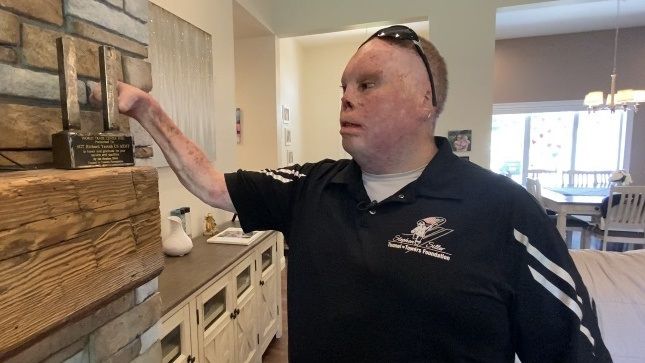 For wounded vet, life changed in an instant