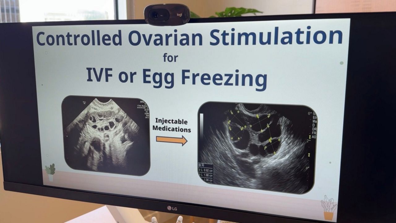 New California law expands infertility treatment coverage