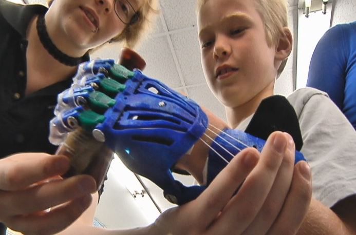 7-Year-Old Receives Prosthetic Hand Designed, Assembled by 9th Graders