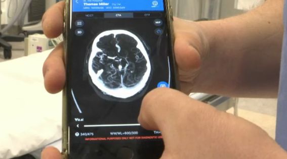 Raising awareness for stroke detection and prevention